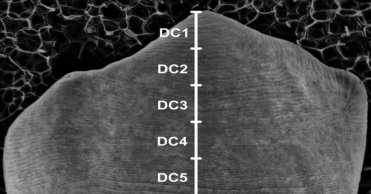 AI revolutionizes dental anthropology research - Türkiye Today